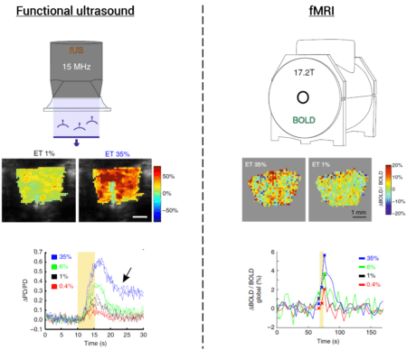 What is fUS - Iconeus