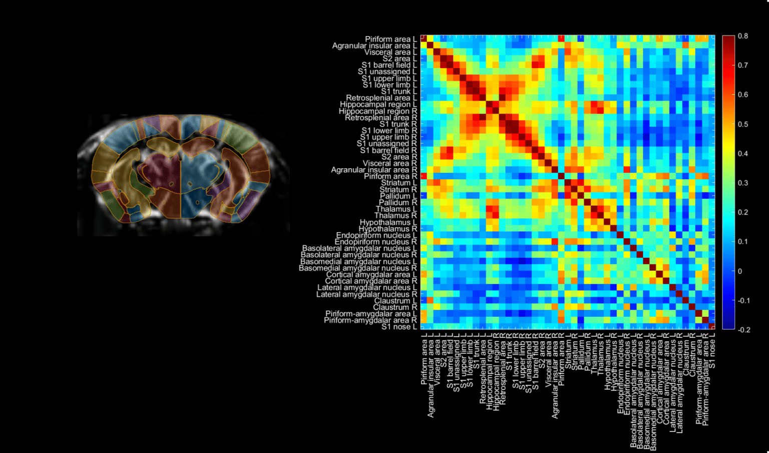 Resting State Functional Connectivity Iconeus
