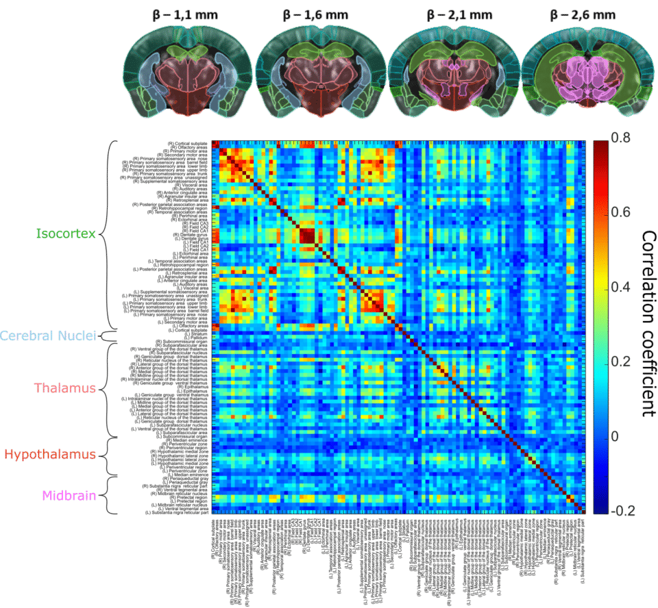 Resting-state functional connectivity - Iconeus