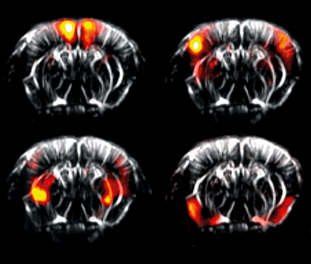 Resting-state functional connectivity - Iconeus